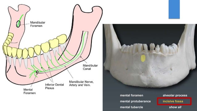 Maxilla, Mandible & Hyoid Bone by Dr. RIG.pptx