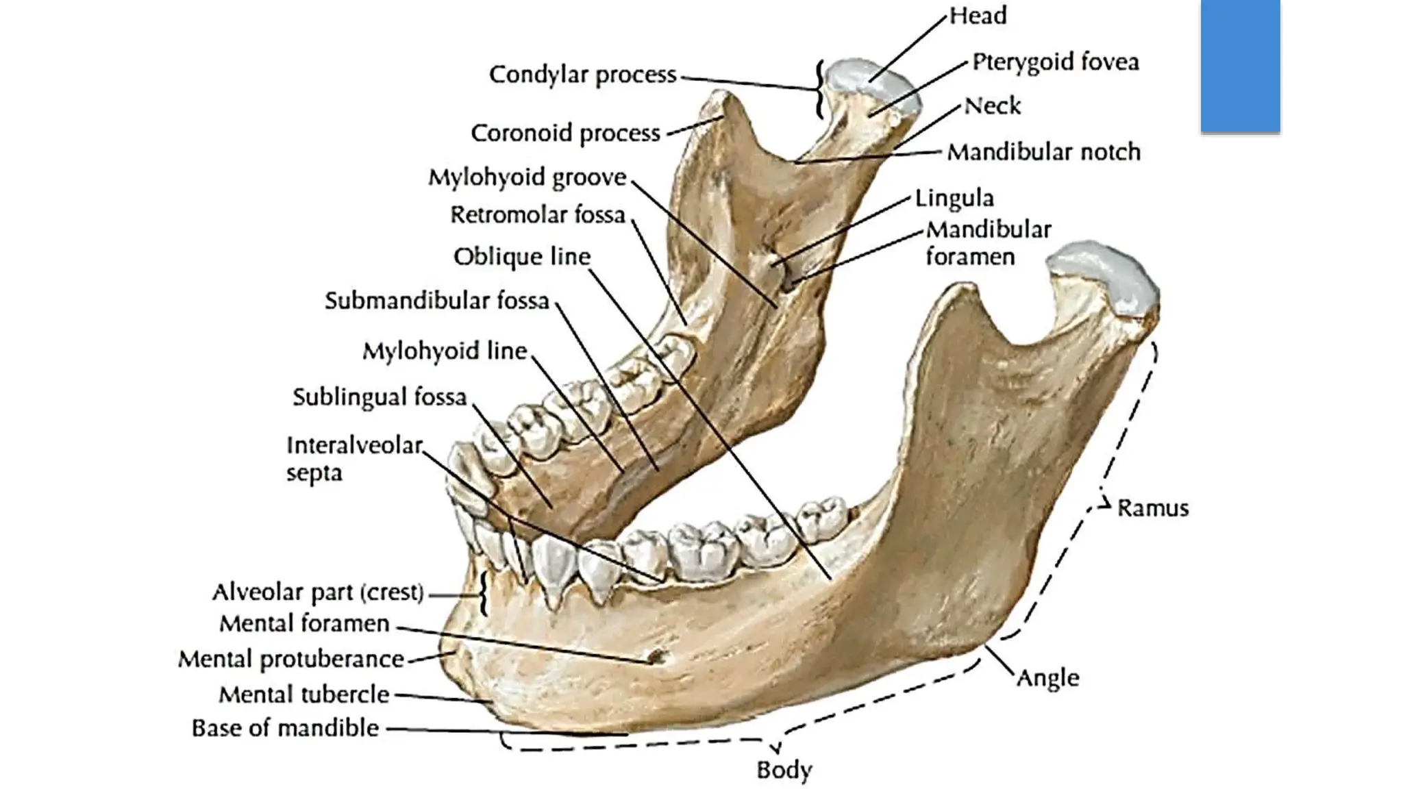 Maxilla, Mandible & Hyoid Bone & Clinical Correlations by Dr. RIG.pptx