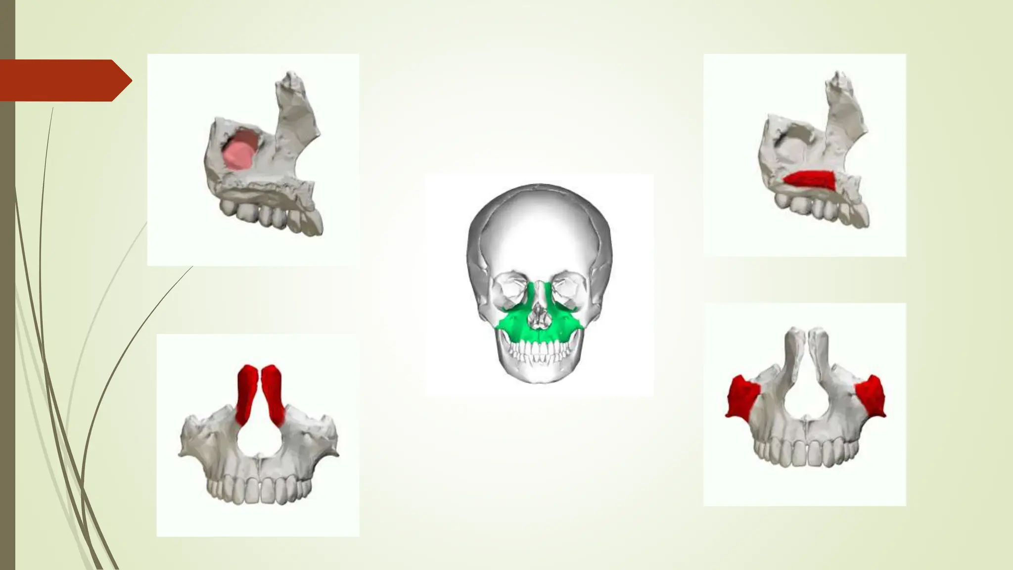 SURGICAL AND APPLIED ANATOMY OF MAXILLA. | PPTX