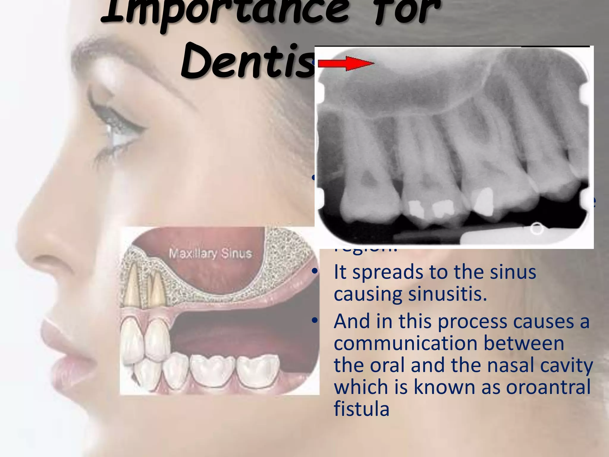 Maxillary sinus for dental students year 1 | PPTX