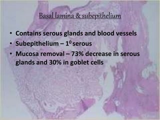 Maxillary sinus for dental students year 1 | PPTX