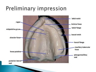 Maxillary denture-landmarks | PPTX