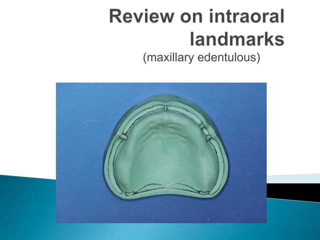 Maxillary denture-landmarks | PPTX