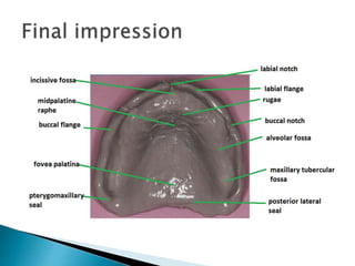 Maxillary denture-landmarks | PPTX
