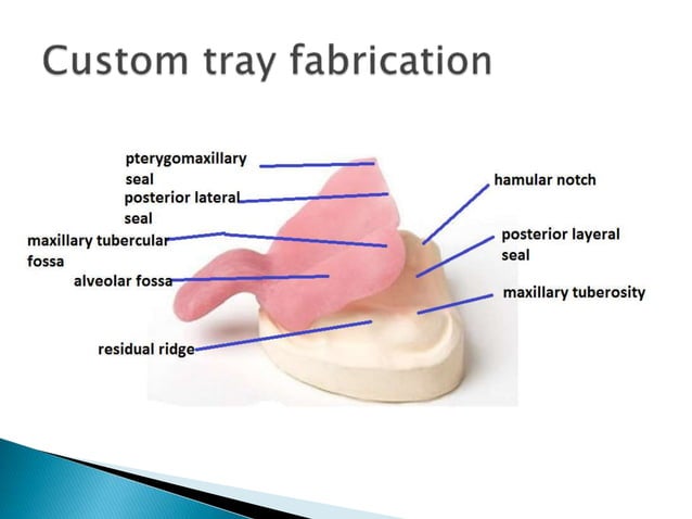 Maxillary denture-landmarks | PPT