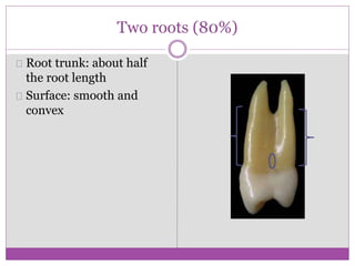 Maxillary 1st premolar | PPTX