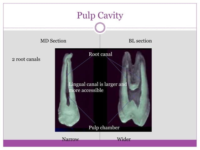 Maxillary 1st premolar | PPTX | Dental Health | Diseases and Conditions