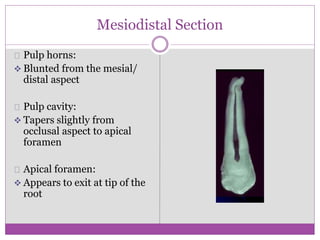 Maxillary 1st premolar | PPTX