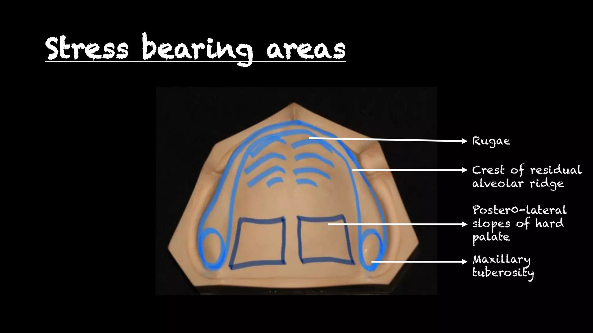 ANATOMICAL LANDMARKS OF EDENTULOUS MAXILLA | PDF