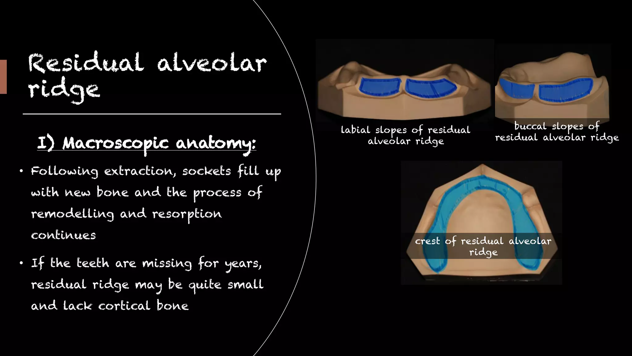 ANATOMICAL LANDMARKS OF EDENTULOUS MAXILLA | PDF