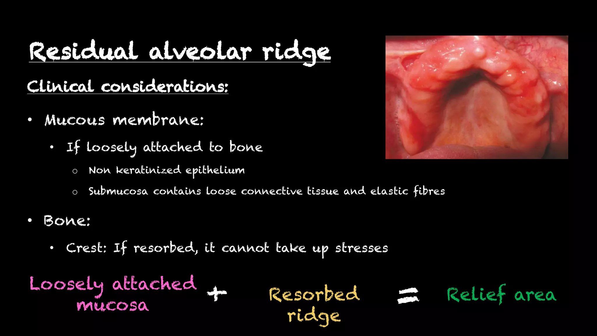 ANATOMICAL LANDMARKS OF EDENTULOUS MAXILLA | PDF