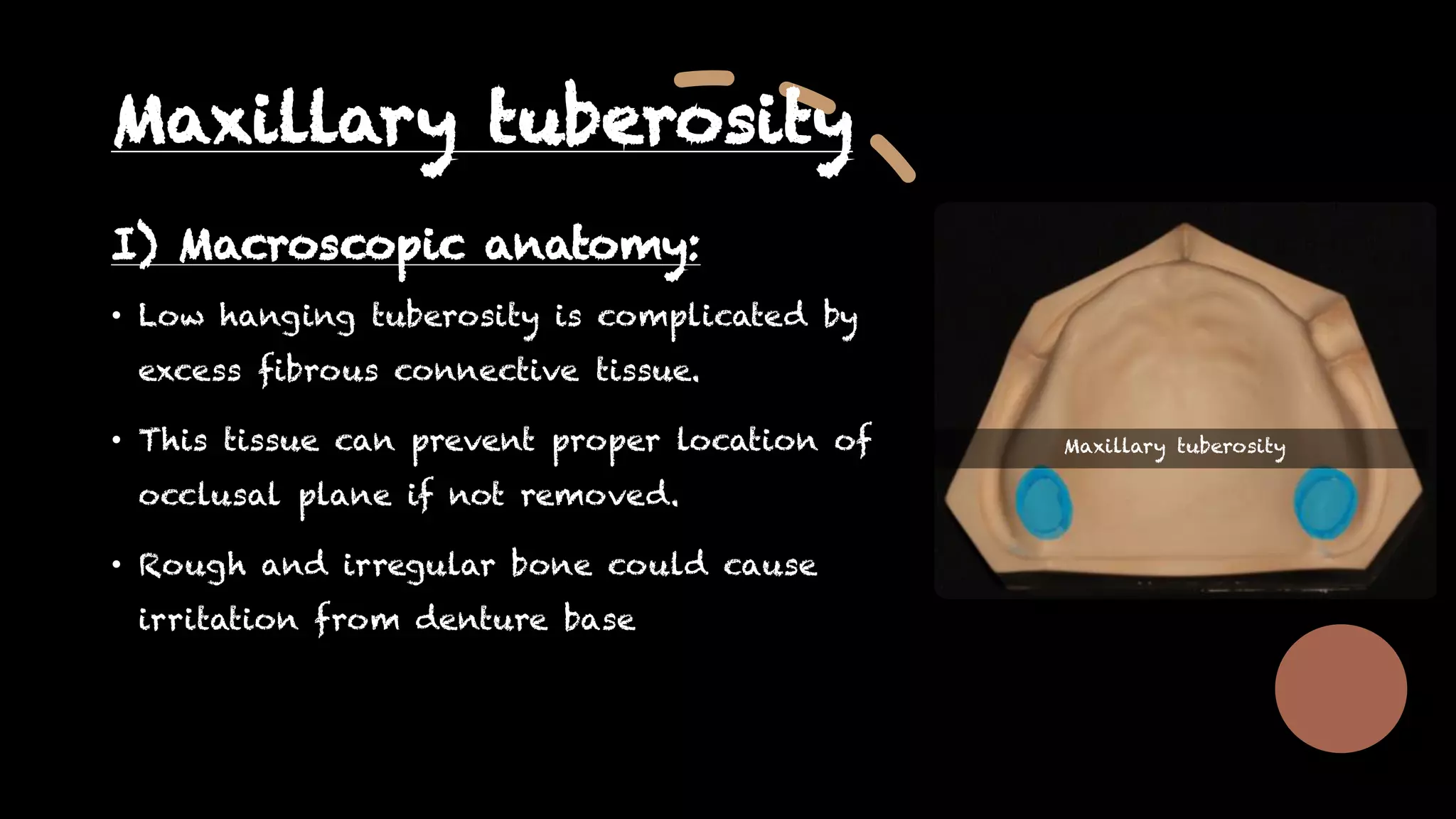 ANATOMICAL LANDMARKS OF EDENTULOUS MAXILLA | PDF