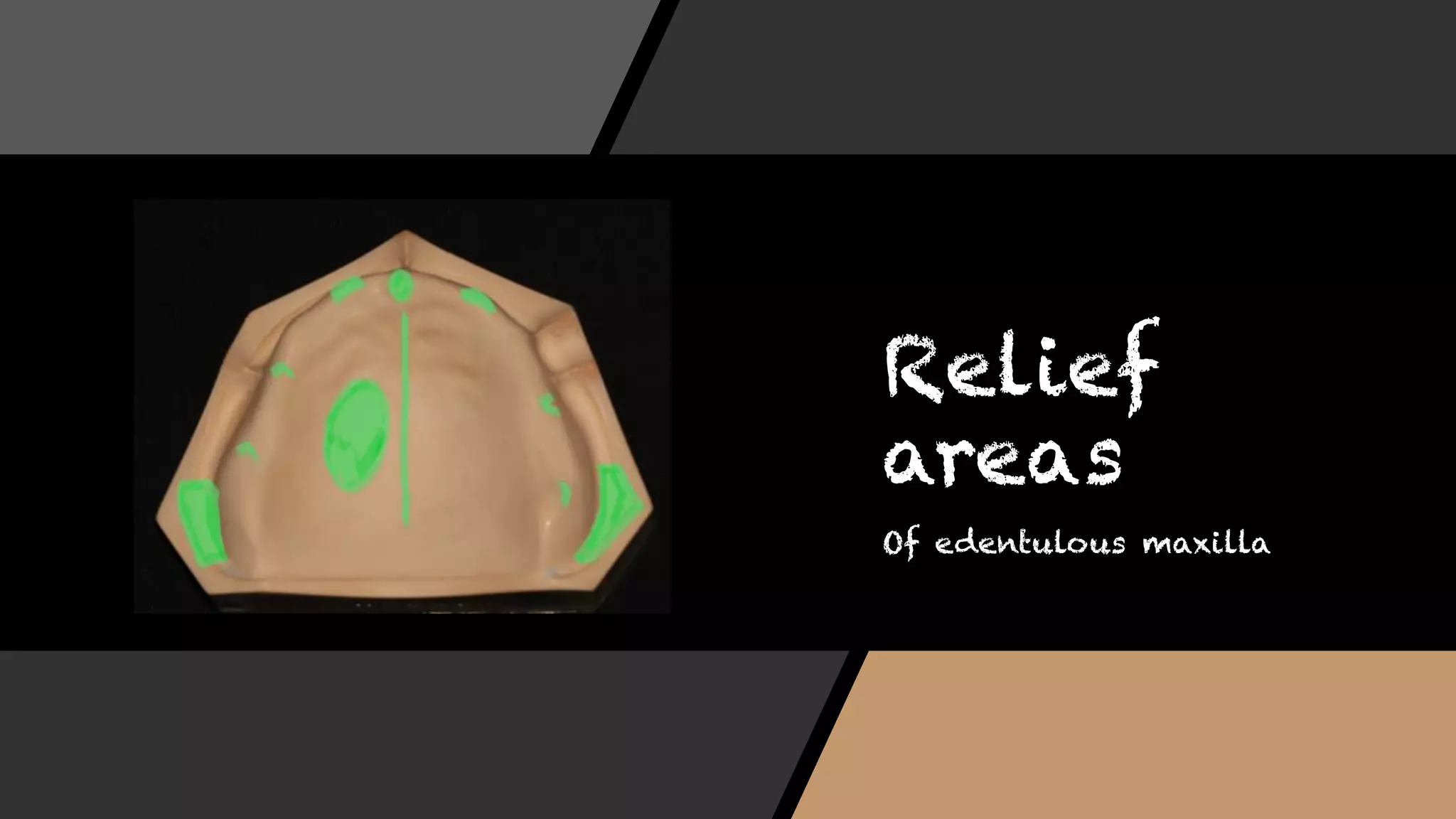 ANATOMICAL LANDMARKS OF EDENTULOUS MAXILLA | PDF