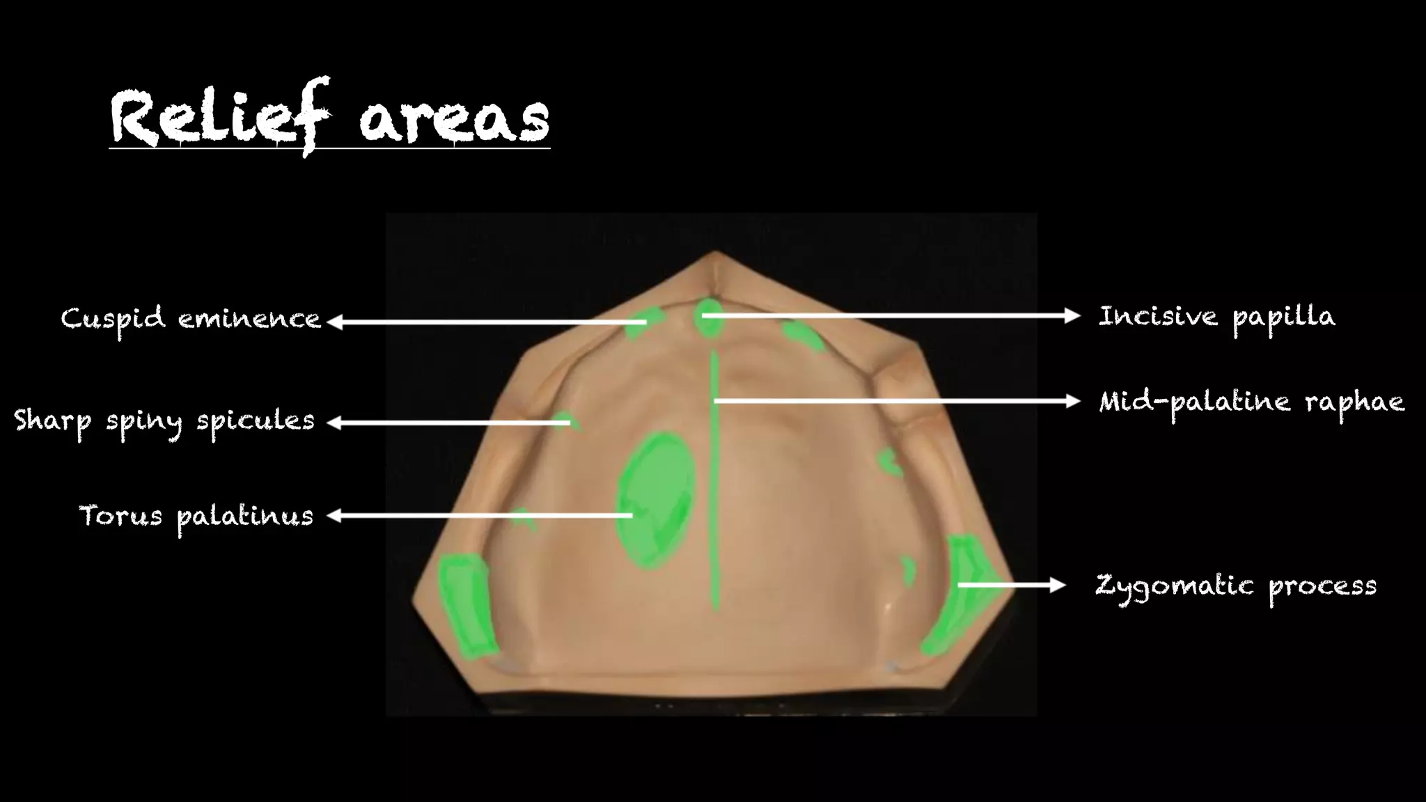 ANATOMICAL LANDMARKS OF EDENTULOUS MAXILLA | PDF