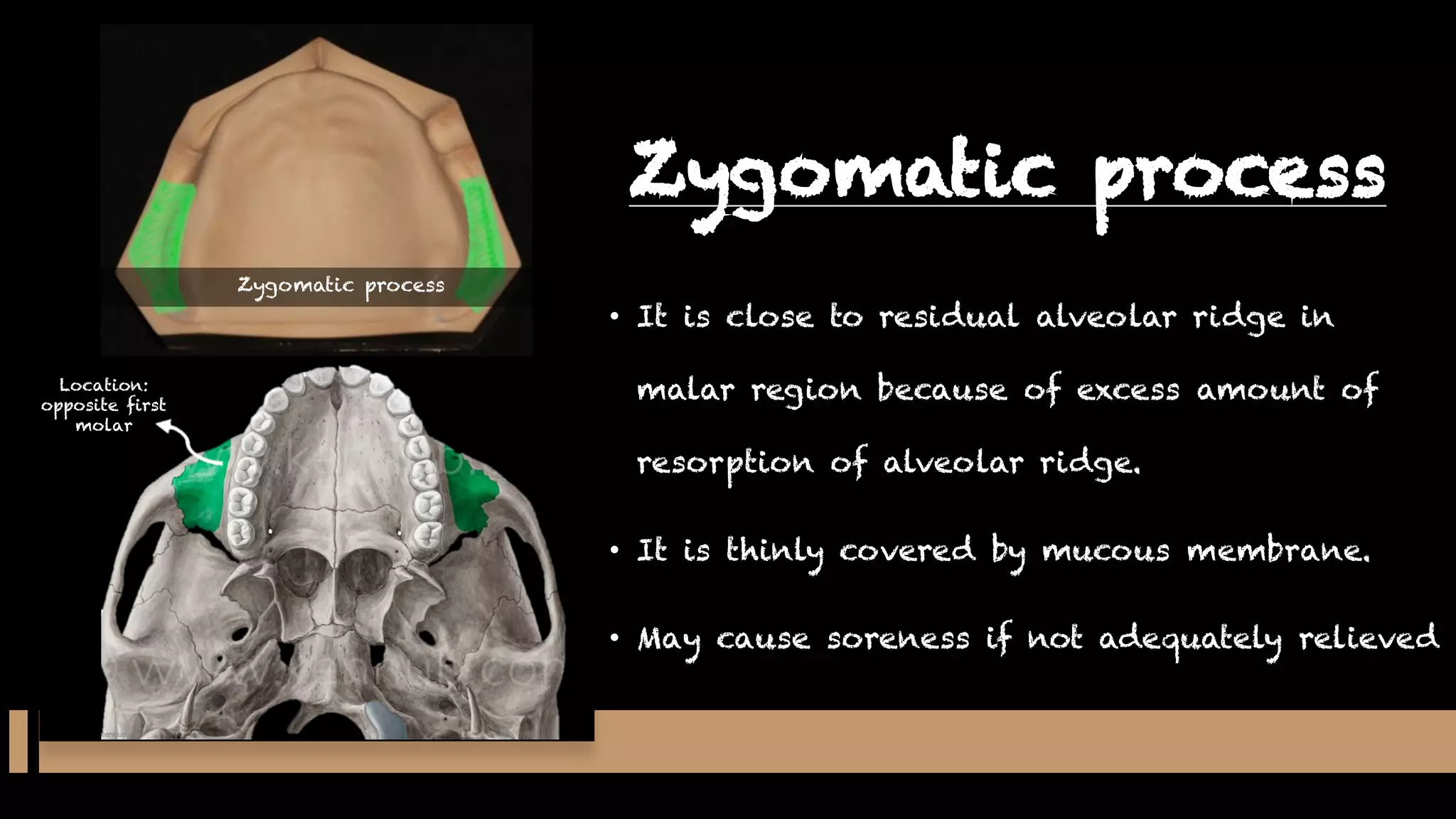 ANATOMICAL LANDMARKS OF EDENTULOUS MAXILLA | PDF
