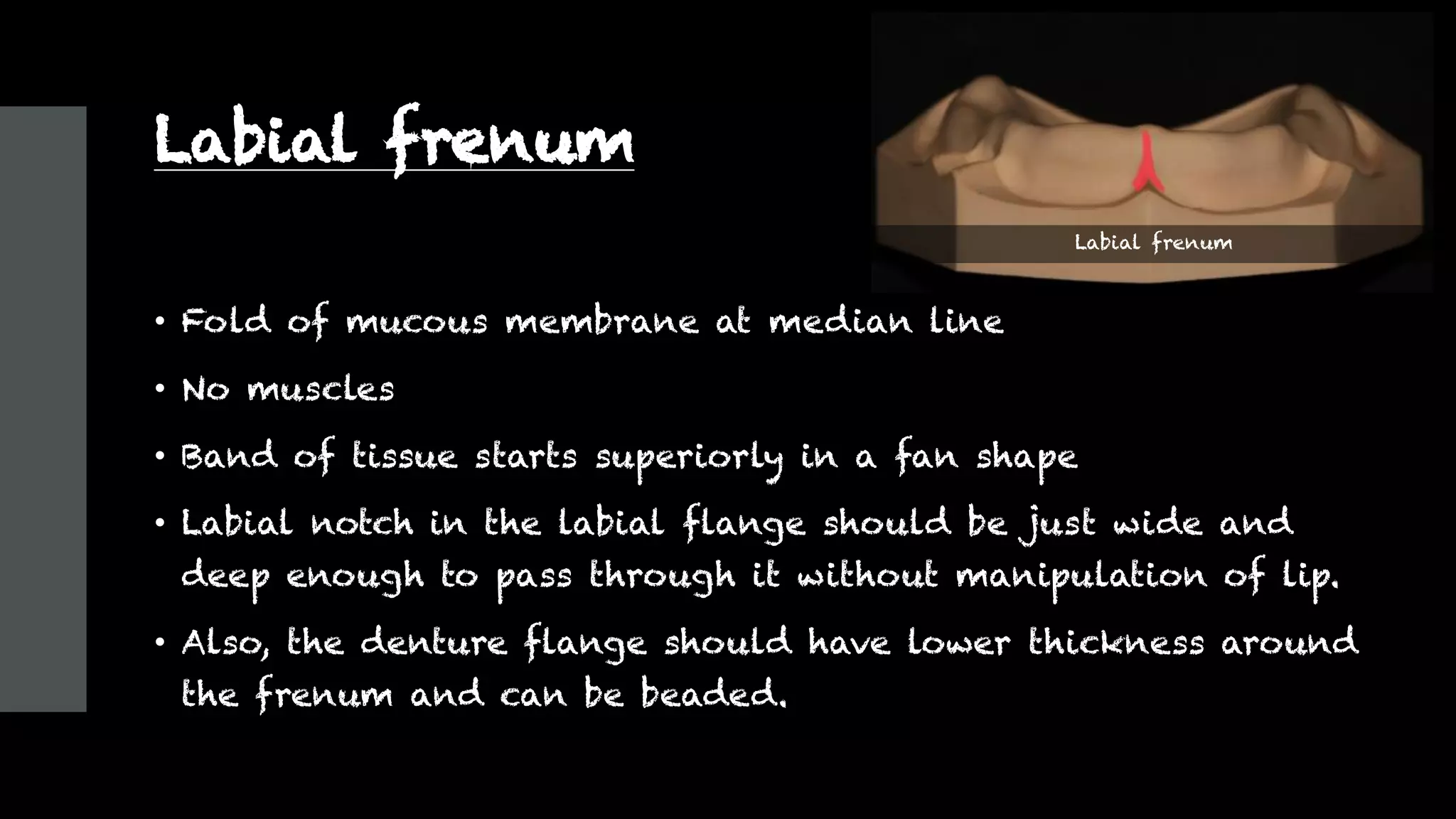 ANATOMICAL LANDMARKS OF EDENTULOUS MAXILLA | PDF