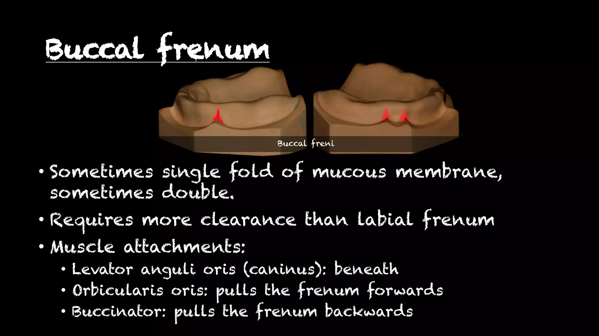 ANATOMICAL LANDMARKS OF EDENTULOUS MAXILLA | PDF