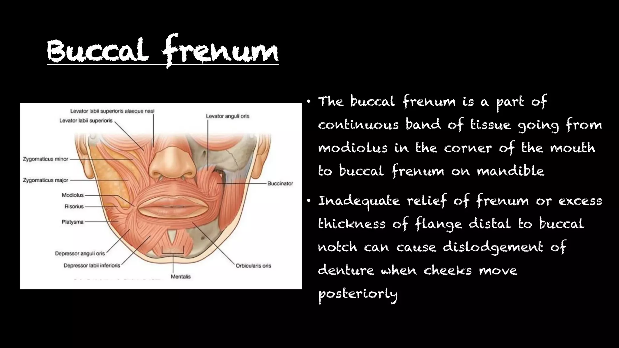 ANATOMICAL LANDMARKS OF EDENTULOUS MAXILLA | PDF