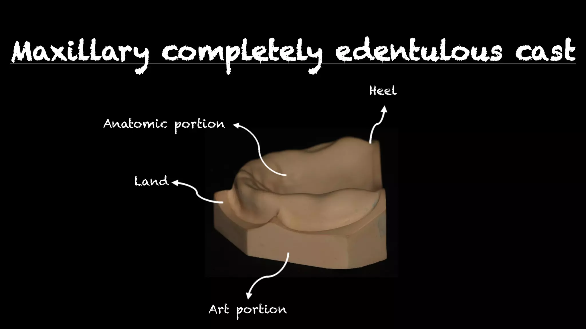 ANATOMICAL LANDMARKS OF EDENTULOUS MAXILLA | PDF