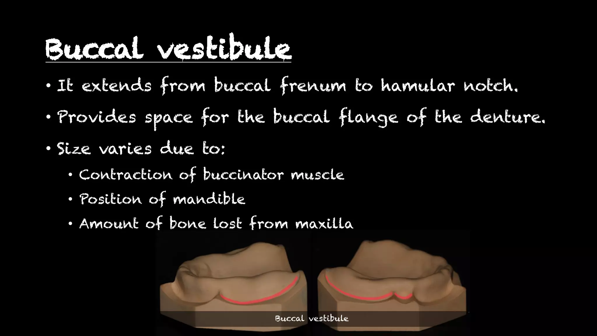 ANATOMICAL LANDMARKS OF EDENTULOUS MAXILLA | PDF