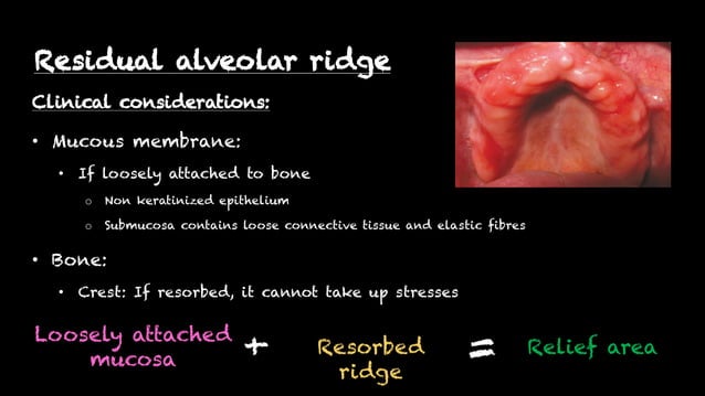 ANATOMICAL LANDMARKS OF EDENTULOUS MAXILLA | PDF