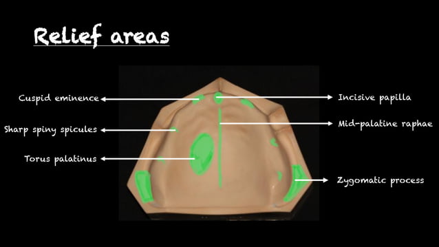 ANATOMICAL LANDMARKS OF EDENTULOUS MAXILLA | PDF
