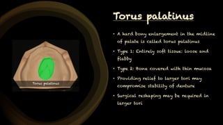 ANATOMICAL LANDMARKS OF EDENTULOUS MAXILLA | PDF