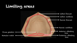 ANATOMICAL LANDMARKS OF EDENTULOUS MAXILLA | PDF