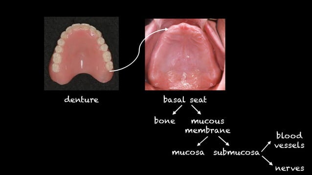 ANATOMICAL LANDMARKS OF EDENTULOUS MAXILLA | PDF
