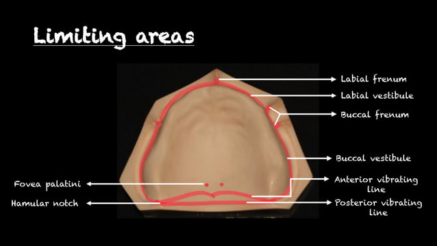 ANATOMICAL LANDMARKS OF EDENTULOUS MAXILLA | PPT