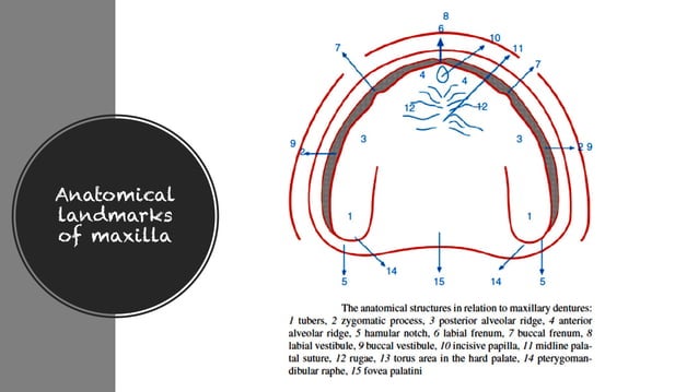 ANATOMICAL LANDMARKS OF EDENTULOUS MAXILLA | PPT
