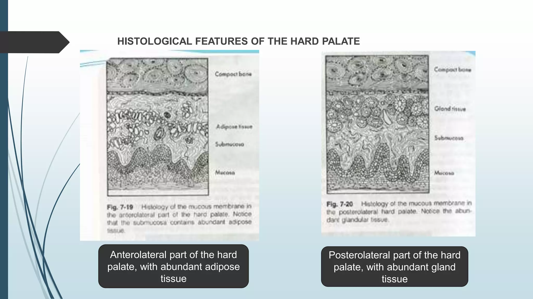 MAXILLARY ANATOMICAL LANDMARKS.pptx