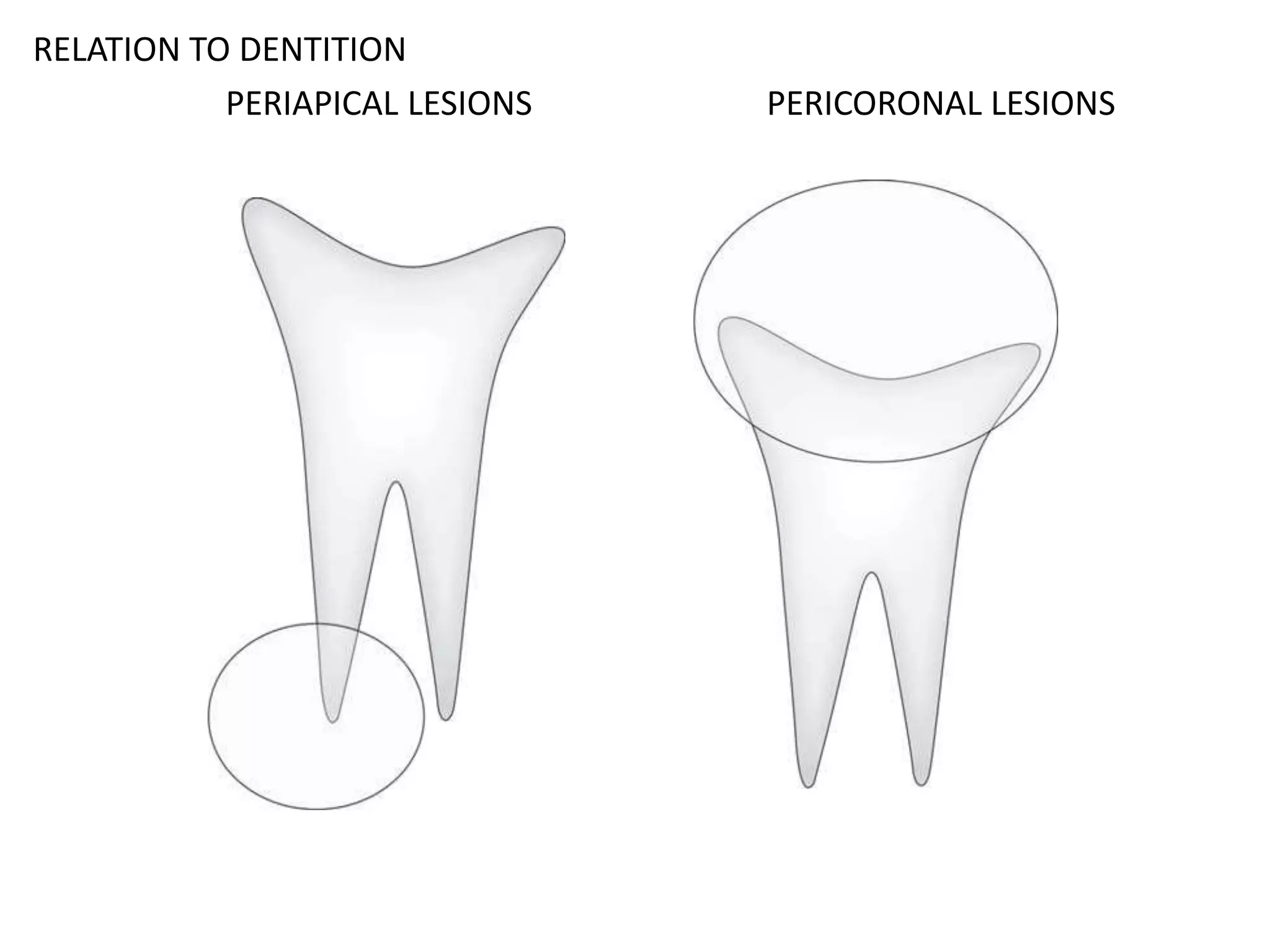 Maxillary and jaw lesions | PPTX