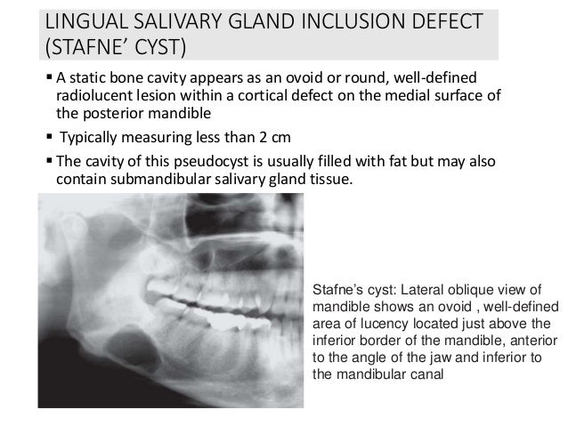Maxillary And Jaw Lesions