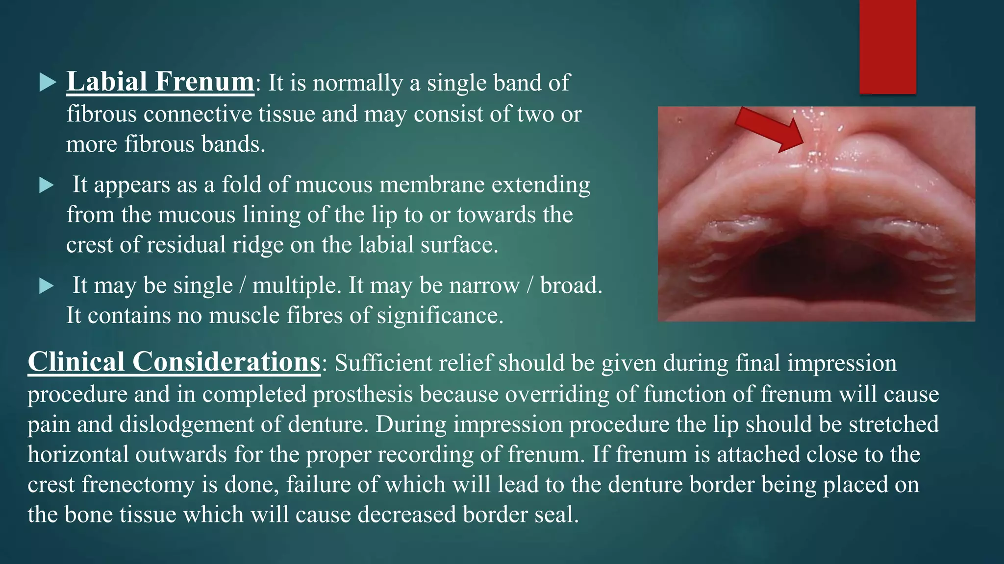 Maxillary and mandbular anatomical landmarks | PPTX