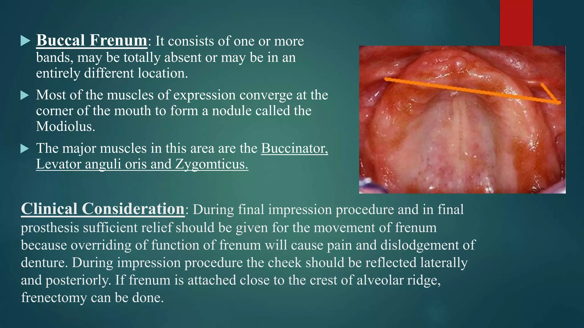 Maxillary and mandbular anatomical landmarks | PPTX
