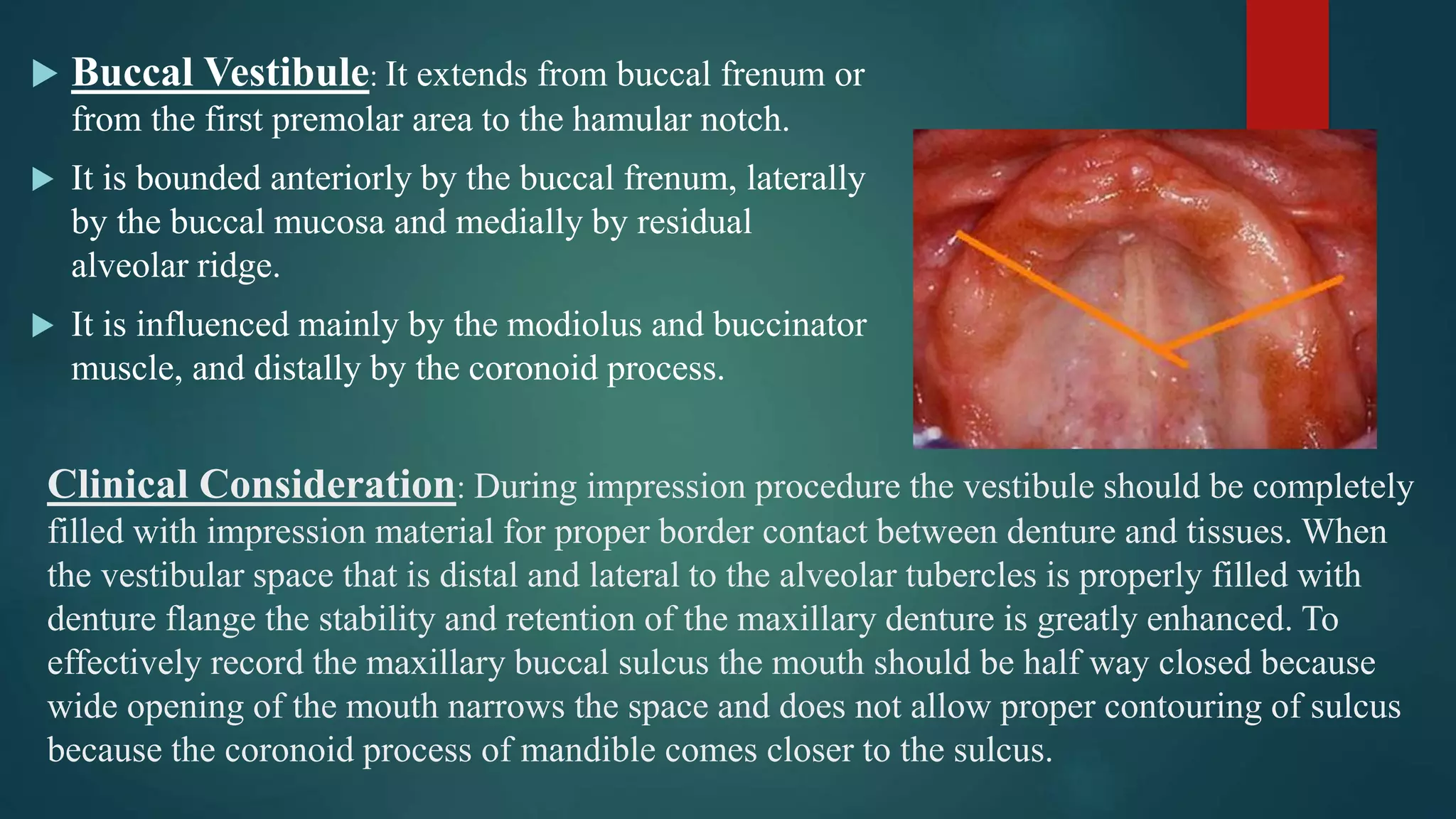 Maxillary and mandbular anatomical landmarks | PPTX