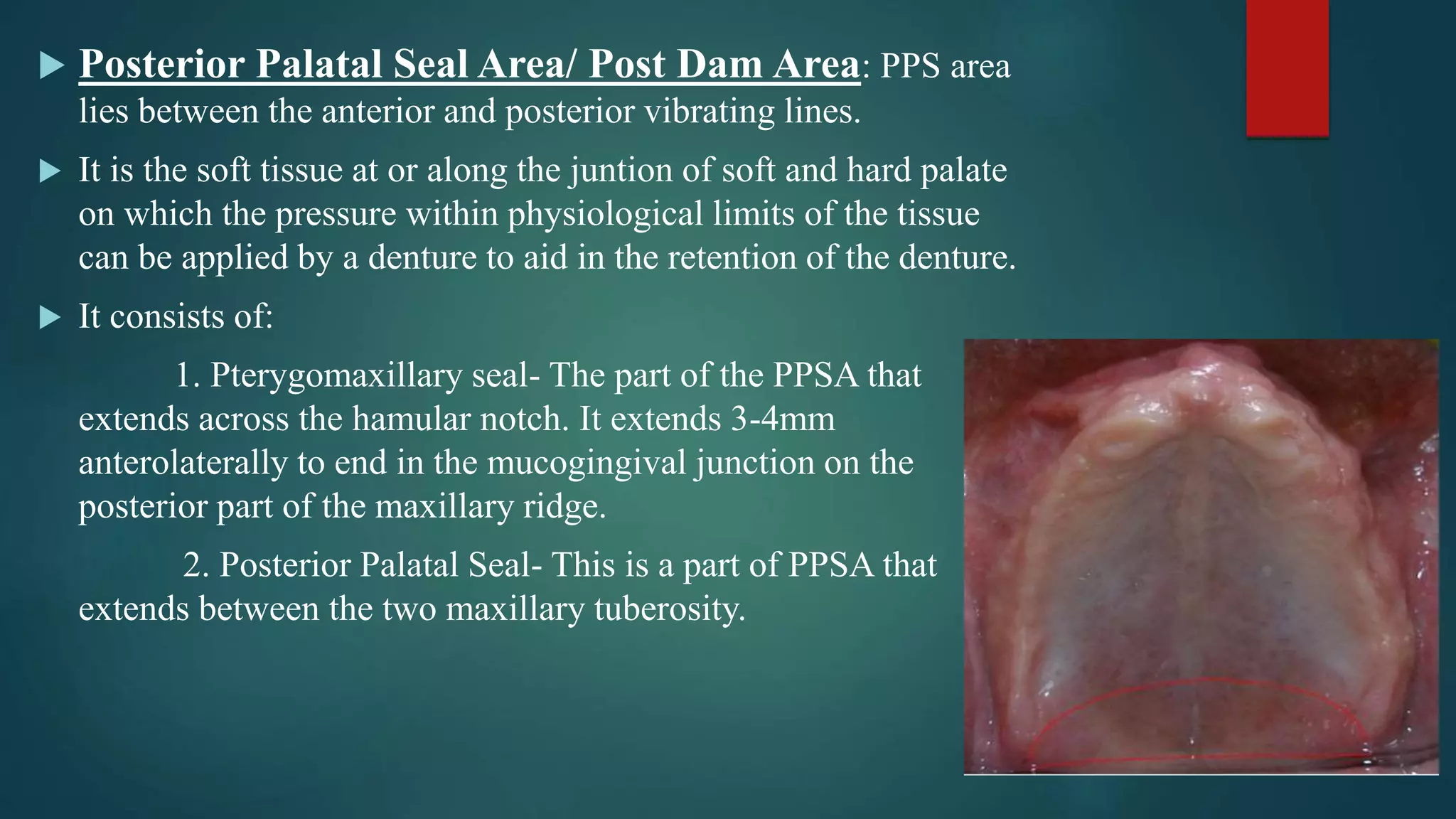 Maxillary and mandbular anatomical landmarks | PPTX