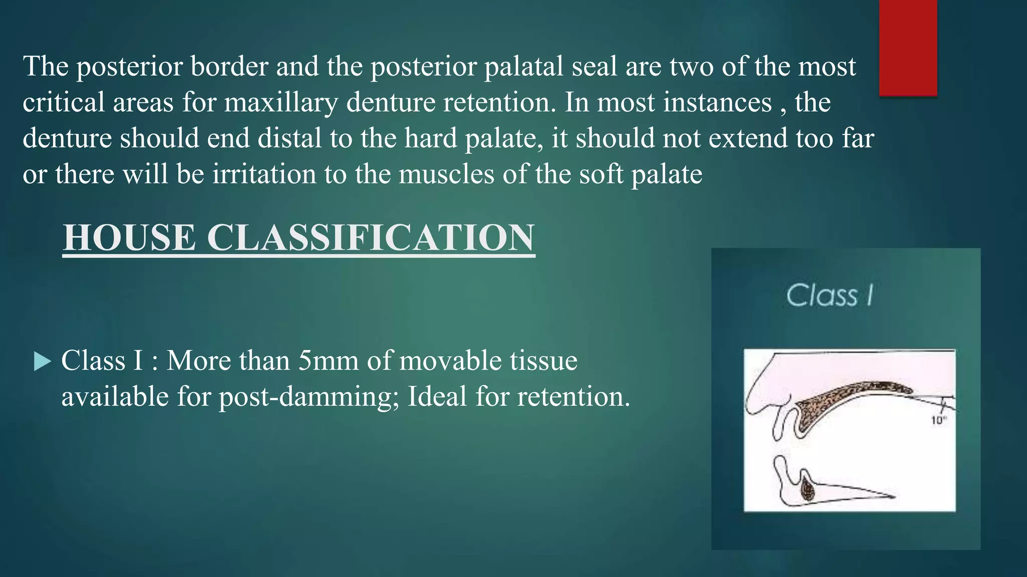 Maxillary and mandbular anatomical landmarks | PPTX