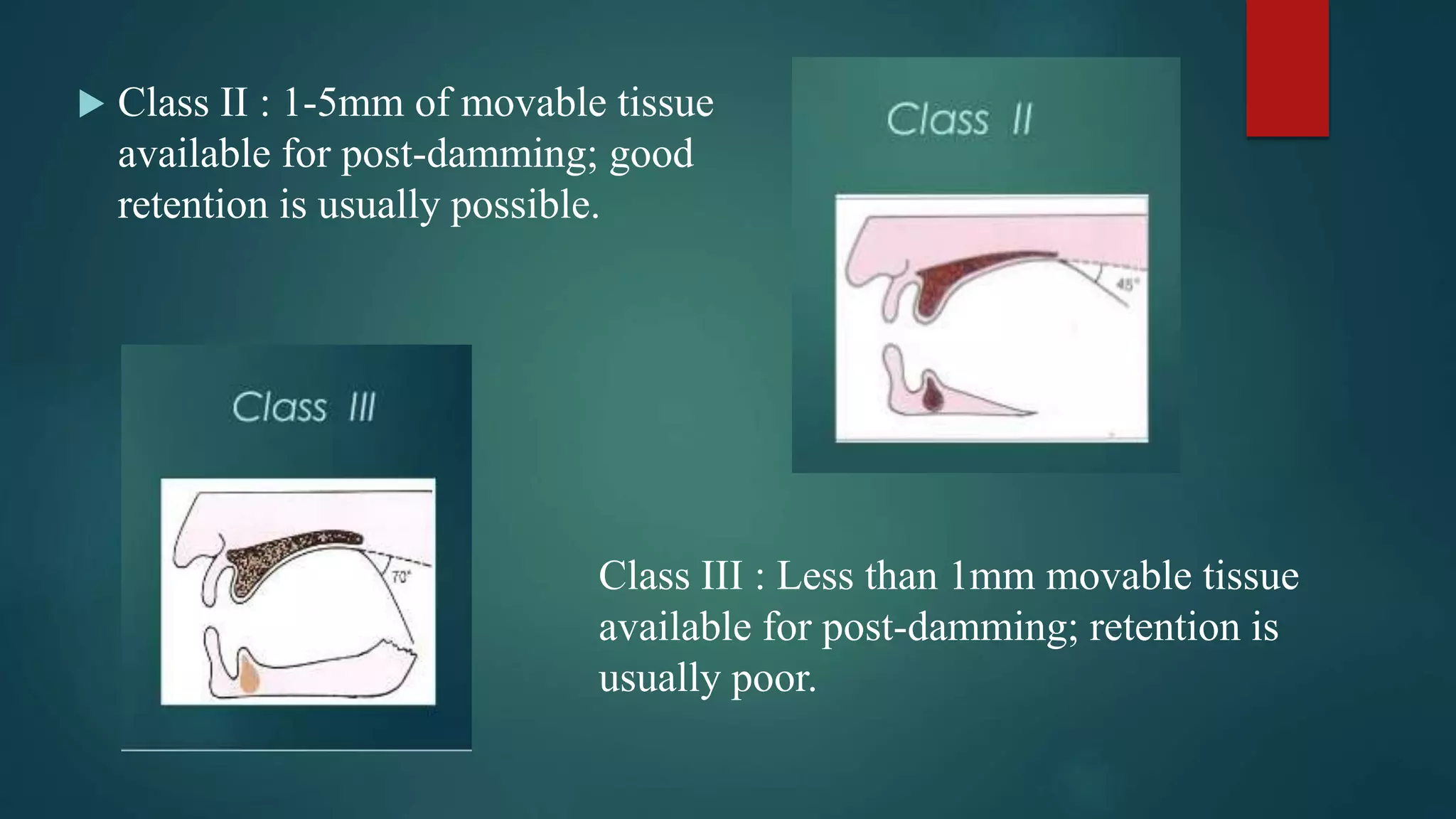 Maxillary and mandbular anatomical landmarks | PPTX