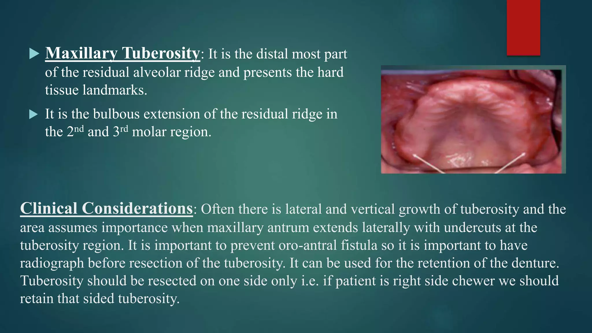 Maxillary and mandbular anatomical landmarks | PPTX