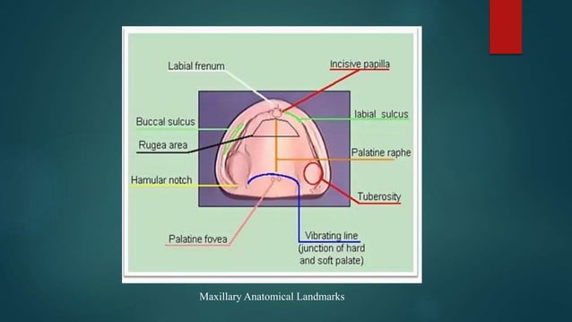 Maxillary and mandbular anatomical landmarks | PPTX | Dental Health ...