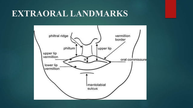 Maxillary and mandbular anatomical landmarks | PPTX | Dental Health ...