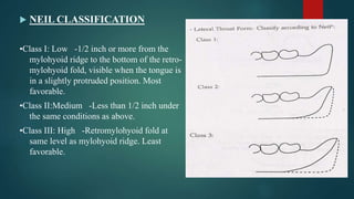 Maxillary and mandbular anatomical landmarks | PPTX