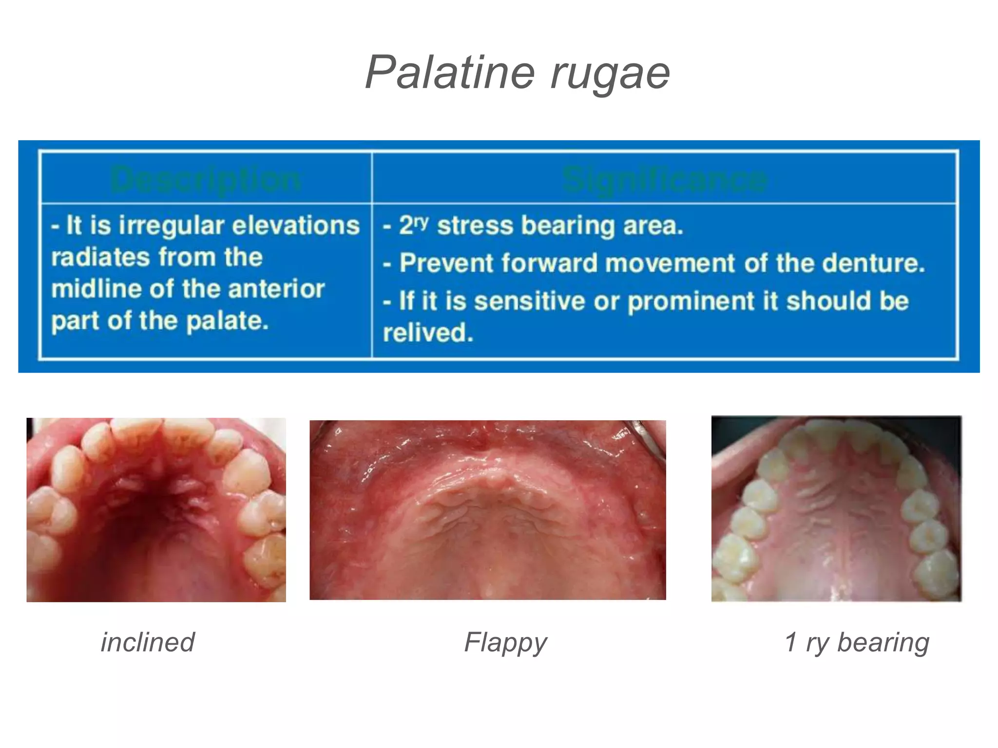 Maxillary and mandibular anatomical land marks | PPTX