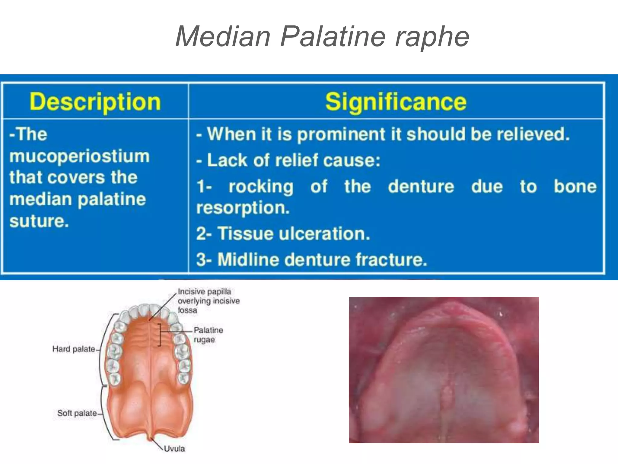 Maxillary and mandibular anatomical land marks | PPTX