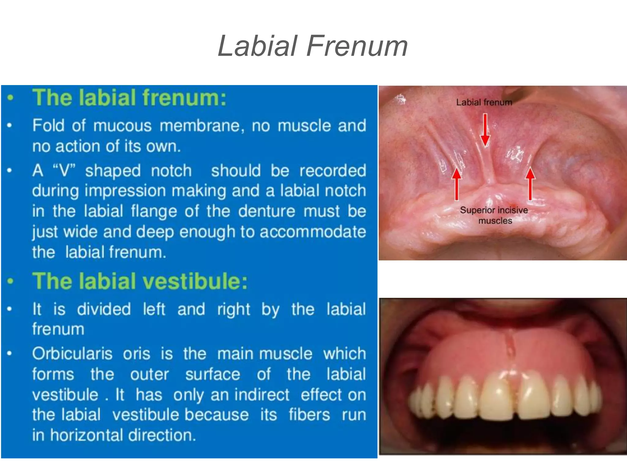 Maxillary and mandibular anatomical land marks | PPTX