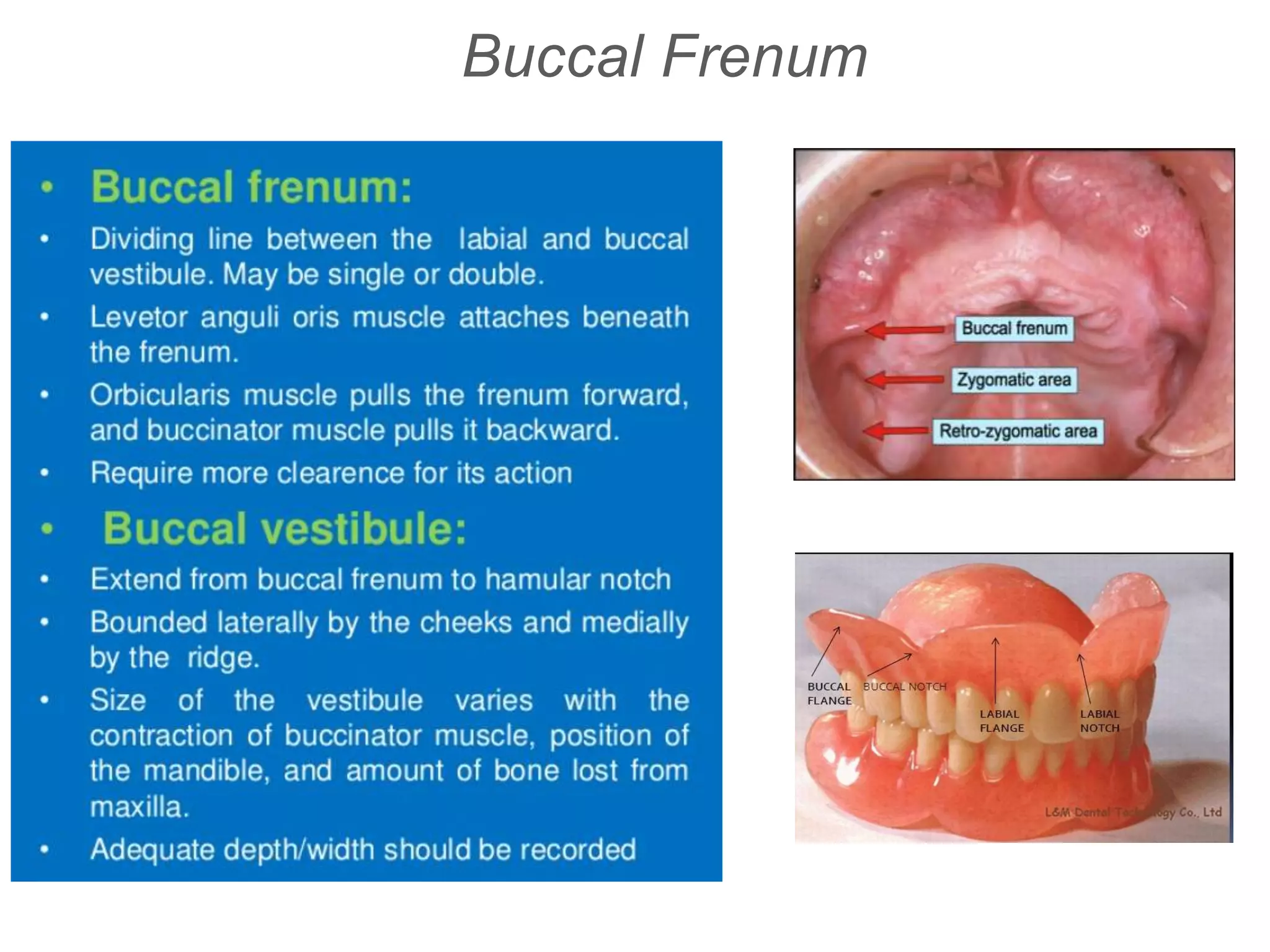Maxillary and mandibular anatomical land marks | PPTX