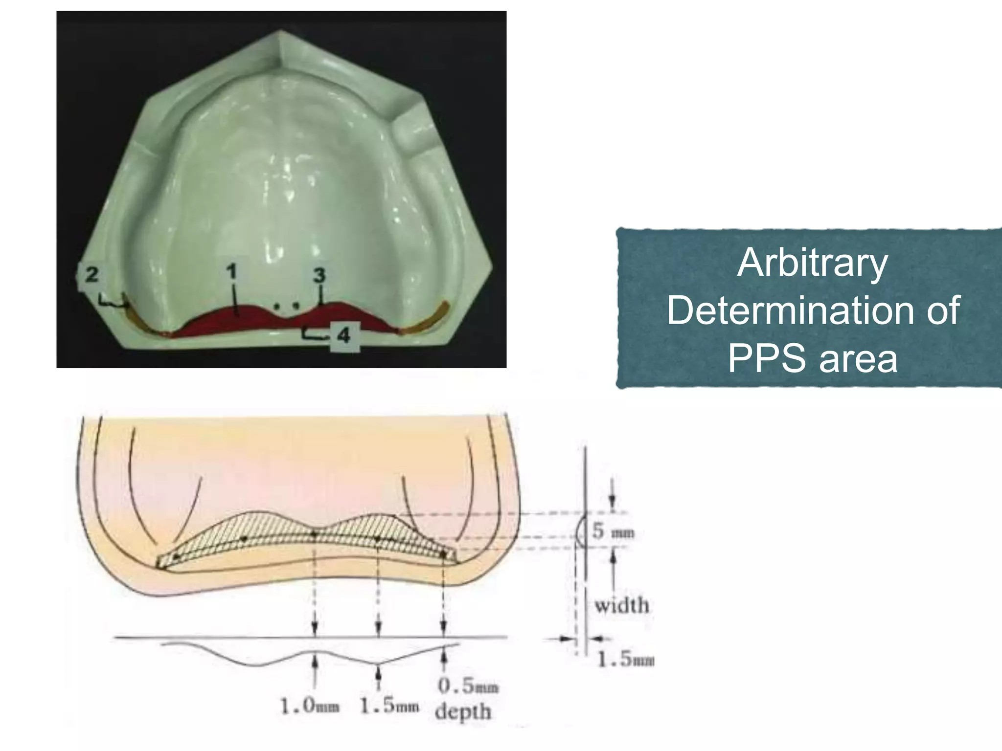 Maxillary and mandibular anatomical land marks | PPTX