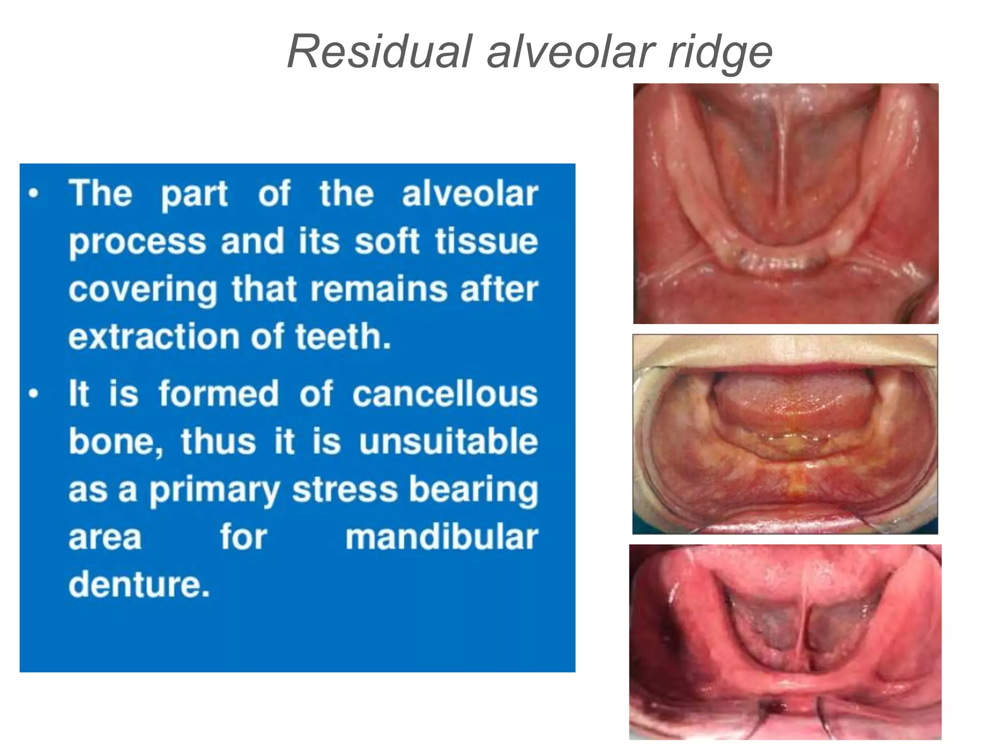 Maxillary and mandibular anatomical land marks | PPTX
